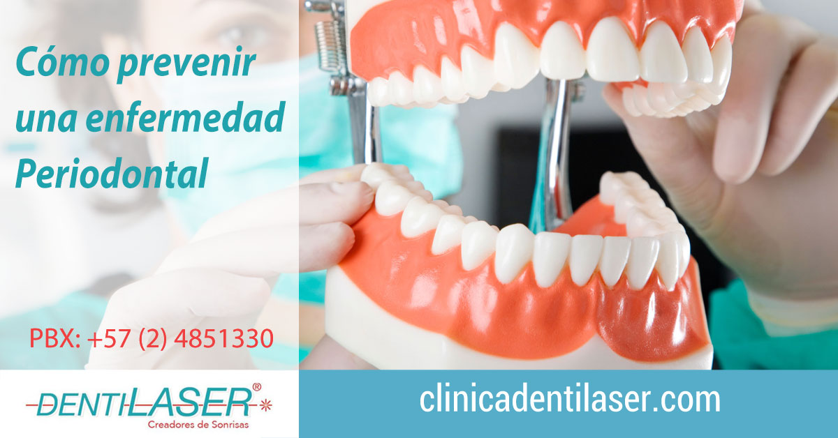Enfermedad Periodontal Severa - Clínica Dentiláser